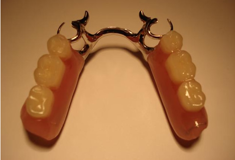 SERVIÇOS - Laboratório de Proteses Vieira